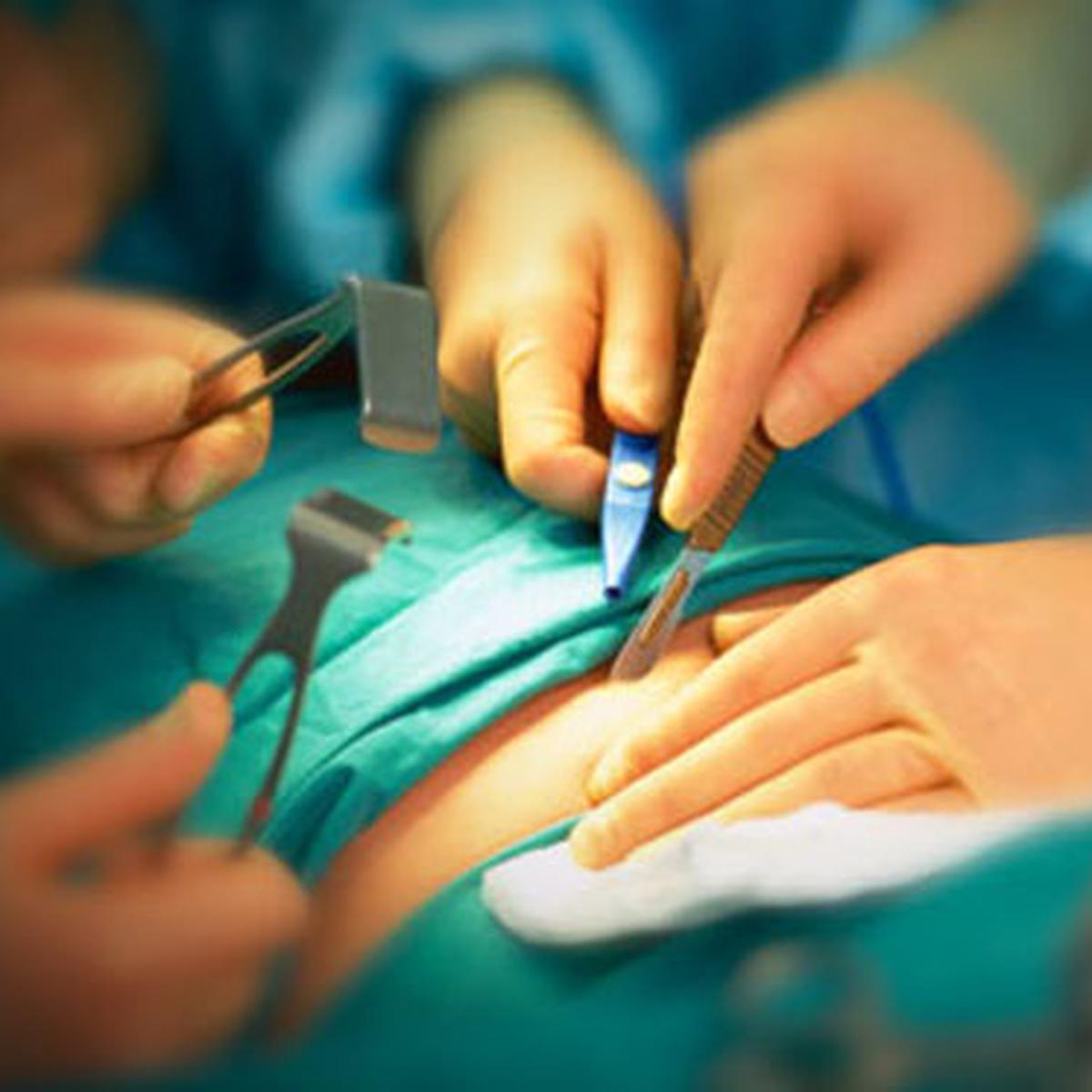 Biaya Operasi Caesar di Rumah Sakit Jakarta dan Sekitarnya | Info Biaya